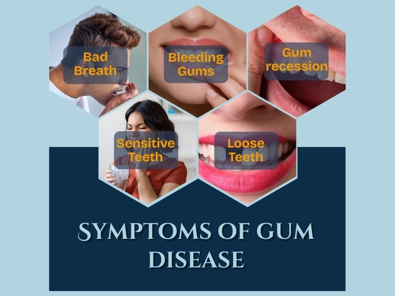 Top 5 Toothpastes for Gingivitis and Gum Disease